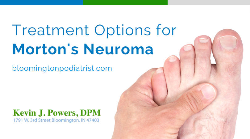 How To Cure Morton's Neuroma - Occasionaction27
